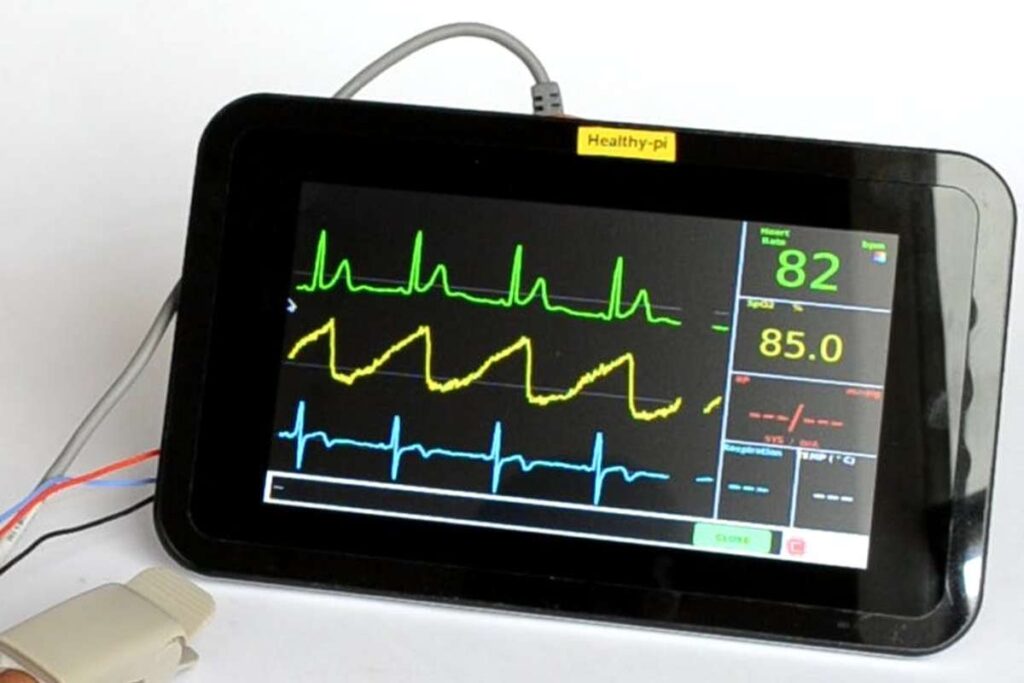 8 Open Source DIY IoT Projects for Hands-On Learning - IoT Hobbyist