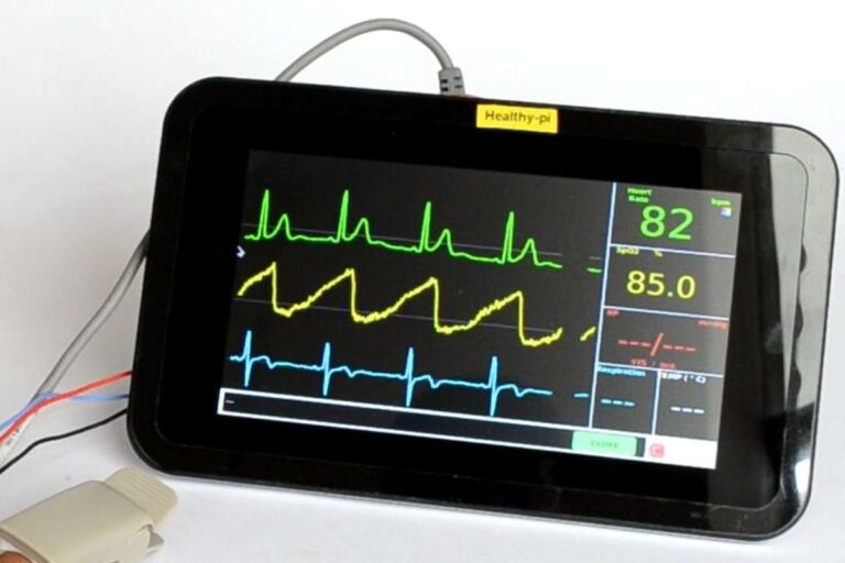 8 Open Source DIY IoT Projects for Hands-On Learning - IoT Hobbyist